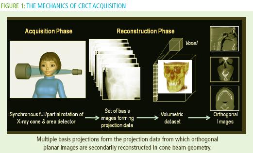 Principles of CBCT Imaging
