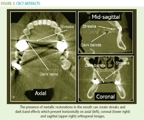 Appropriate Use Of CBCT Imaging